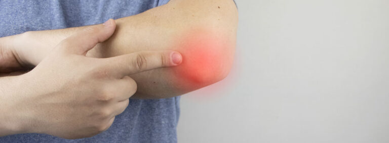 Elbow Fracture - Conditions - Nonsurgical Options - Orlando Hand ...