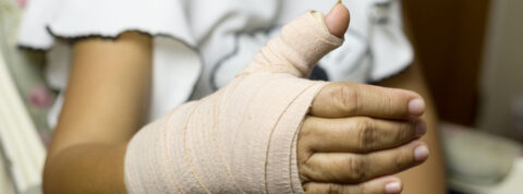 Hand and Finger Fractures - Nonsurgical Options - Orlando Hand Surgery ...