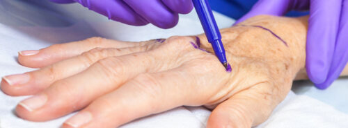 Hand Surgeries - Conditions - Orlando Hand Surgery Associates