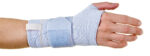 Wrist Tendonitis Surgery - Overview - Preparation - Procedure